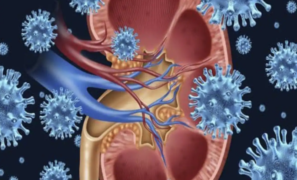 Kidney Doctor Lake Wales